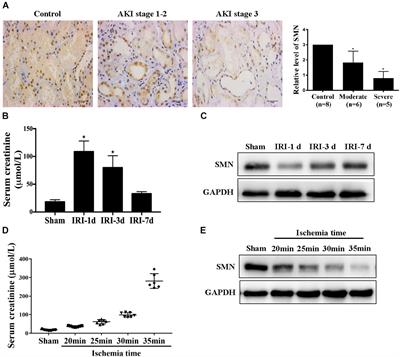 Frontiers | Survival Motor Neuron (SMN) Protein Insufficiency ... Frontiers | Survival Motor Neuron (SMN) Protein Insufficiency ...